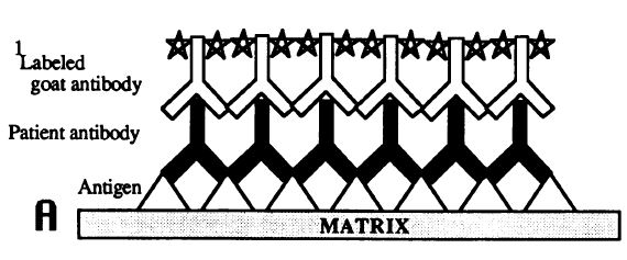 Enzyme immunoassays (EIA) unpacked | Microbiology and Infectious ...